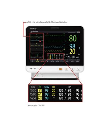 Mindray ePM 10M/12M Patient Monitors