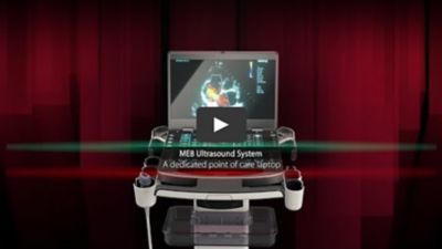 Mindray’s New Point of Care Ultrasound System Redefines What’s Possible