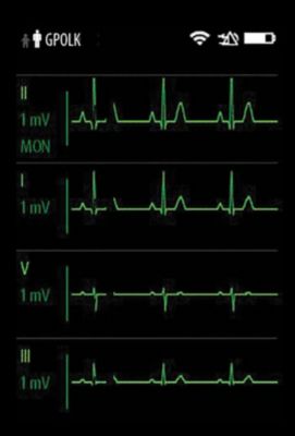 BeneVision TM70 Patient Monitor - Display Telemetry Transmitter