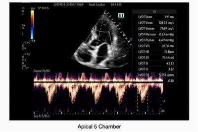 ME8 Portable Ultrasound Machines by Mindray