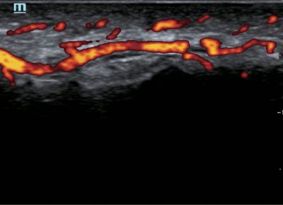 TE5 Ultrasound System by Mindray