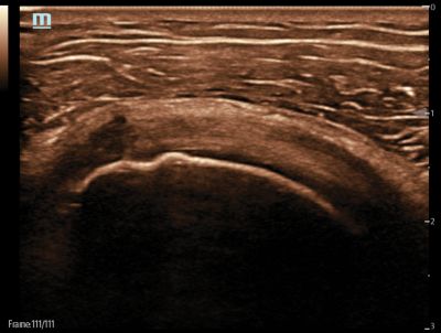 TE5 Ultrasound System by Mindray