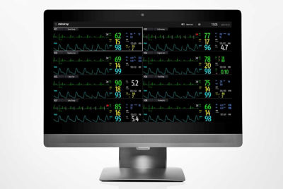 Benevision Distributed Monitoring System Dms