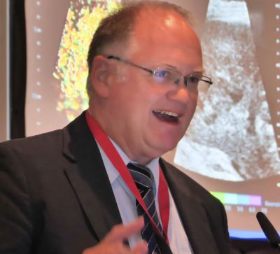 Mindray läutet mit Resona 9 und TEX20 neue Ära der Präzisions ...