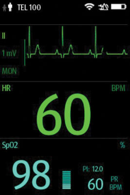 BeneVision TM80 Patient Monitor Telemetry Transmitter